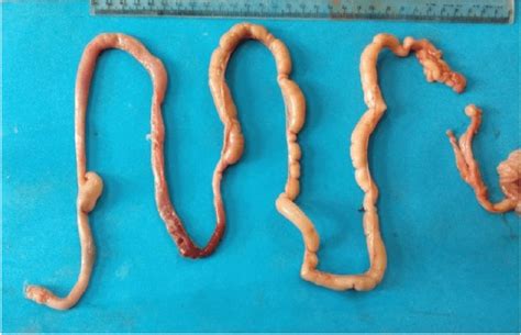 Macroscopic Aspect Of The Small Intestine Duodenum Jejunum And Ileum Download Scientific