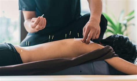 Dry Needling Vs Acupuncture Understanding The Differences
