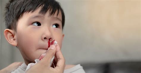 علت خون دماغ شدن کودک چیست؟ کلینیک کودکان آنا