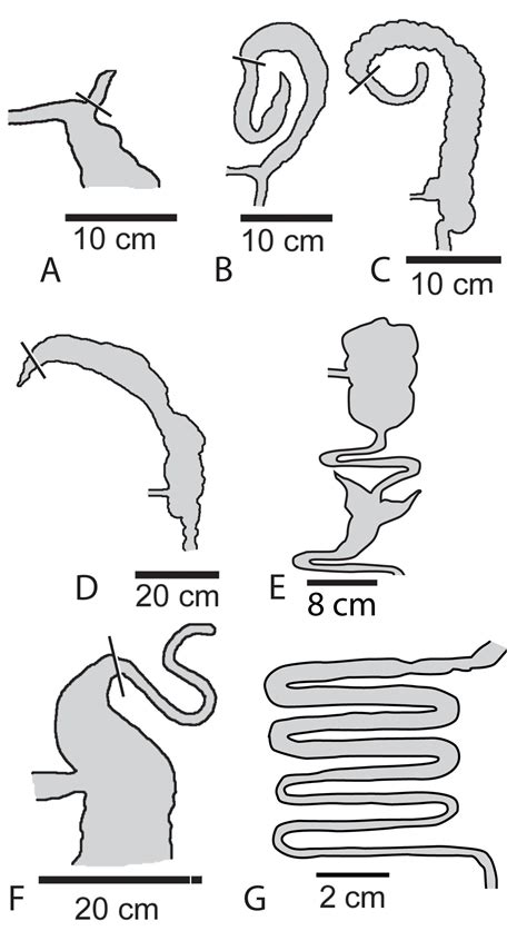 New Research Suggests Appendix May Have Important Function Research Development World