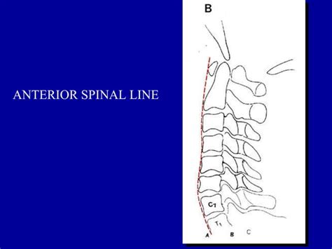 Cervical Spine Injury C Spine Clearing The Cervical Spine Ppt