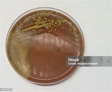 Golden Color Colonies On Chocolate Agar Medium Growth Of Staphylococcus Aureus Gram Positive