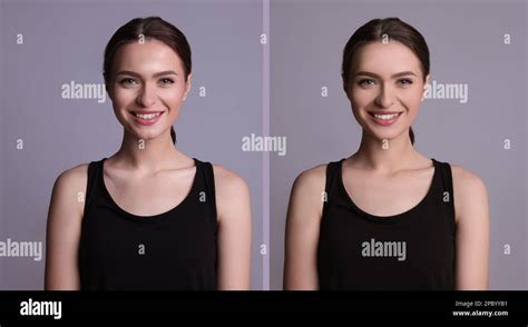 Collage With Photos Of Beautiful Young Woman Before And After Using Mattifying Wipes On Grey