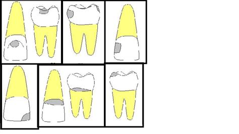 Gv Blacks Classification Diagram Quizlet