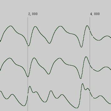 Implemented On FPGA Download Scientific Diagram