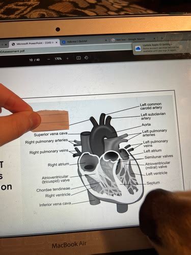Perfusion Pictures Flashcards Quizlet Perfusion Pictures Flashcards Quizlet