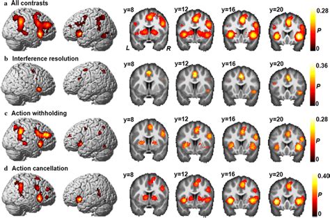 Concordance Of Brain Activation From The Mkda Analyses A Brain Areas
