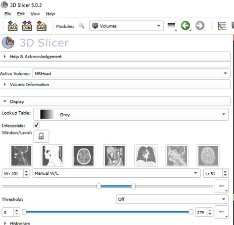 Volumes Module Wl Lock Does Not Lock Wl Slider · Issue 6738 · Slicerslicer · Github