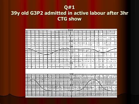 PPT Severe Variable Deceleration With Overshoot However Variability Is Preserved PowerPoint