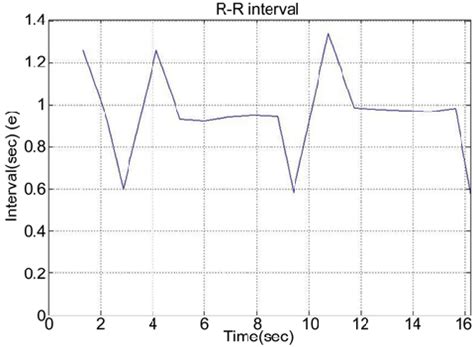 The Result Of R R Interval Calculation Download Scientific Diagram