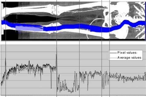 Average And Voxel Density Values Along The Left Leg Vessel Of The