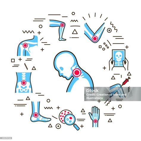 관절염 질병 웹 배너 흰색 배경에 선형 아이콘이 있는 인포그래픽입니다 창의적인 아이디어 개념 격리된 윤곽선 색상 그림 섬유근육통에 대한 스톡 벡터 아트 및 기타 이미지