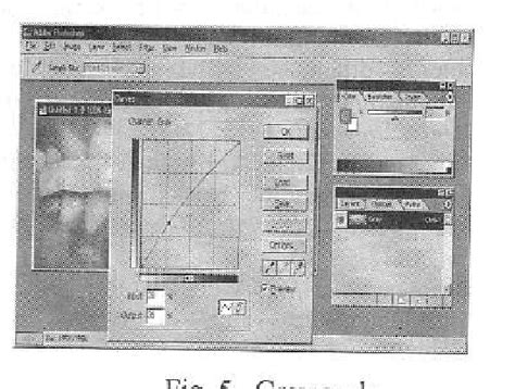 Figure 5 From New Method Using Image Analysis To Measure Gingival Color