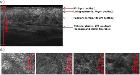 A Histology Like B Scan Extracted From The Lc Oct Acquired 3d Image