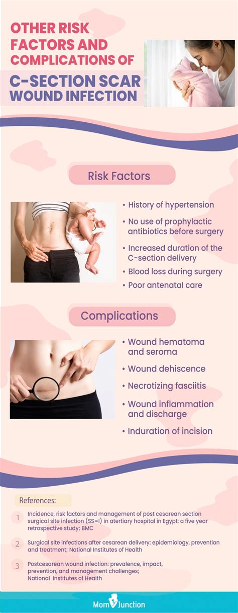 Cesarean Section Incision Types