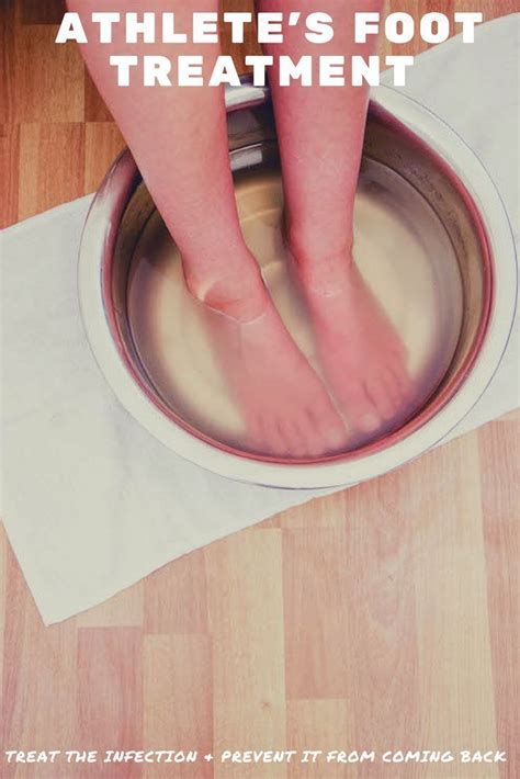 How To Cure Athlete S Foot Can Natural Remedies Help Artofit