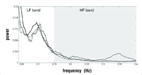 Representative Power Spectrum From A Given Subject In Three Conditions
