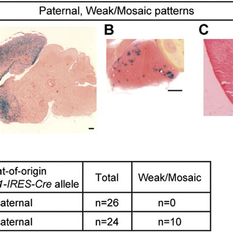 Generating A Foxg1 Ires Cre Knock In Allele By Gene Targeting A