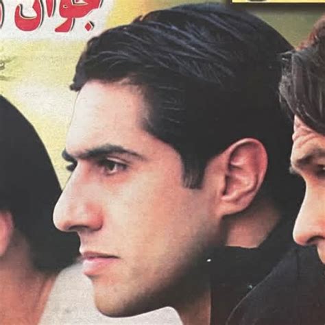 افشین پیروانی قبل از عمل بینی طرفداری