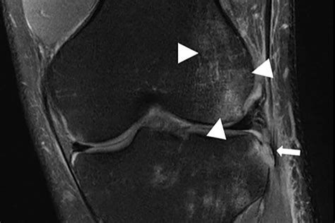 Artificial Intelligence Creates Better Faster Mri Scans Popular Science