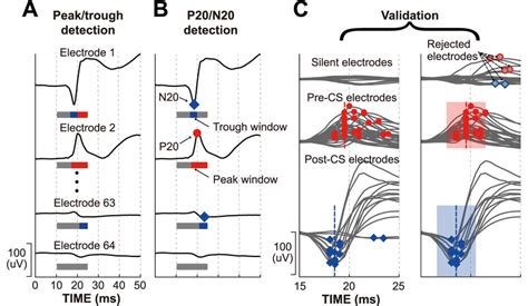 Automated Procedure To Determine Somatosensory Evoked Potentials