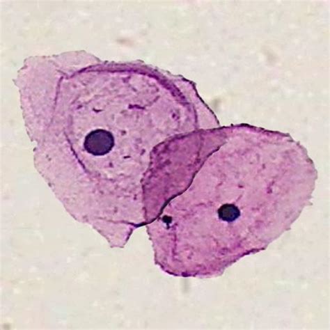 Pap Smear Cell Object Detection Dataset And Pre Trained Model By Pap Smear Sell