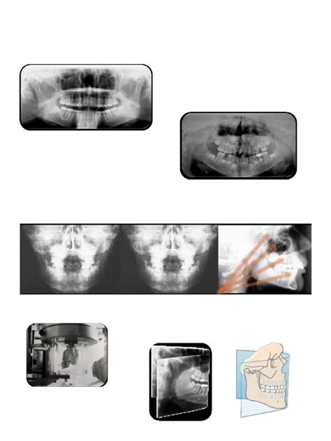 Radiografía Panorámicapdf Pdf Dispositivo De Carga Acoplada