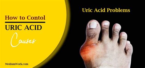 How To Control Uric Acid Problem Medium Work