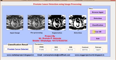 Prostate Cancer Detection Using Image Processing Matlab Source Code