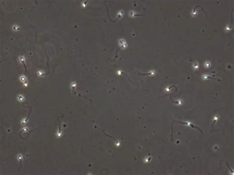 Sperm Video Detection Object Detection Dataset By Yazgan