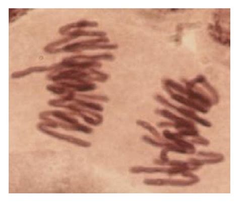 Chromosomal Aberrations And Nuclear Irregularities Observed In Root Tip