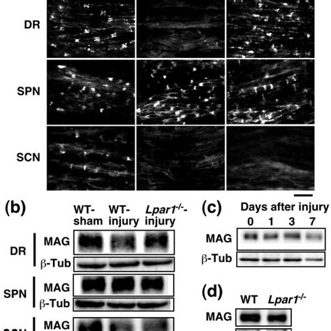 Analysis Of Lpa1 Receptor Dependent And Independent Remak Bundle