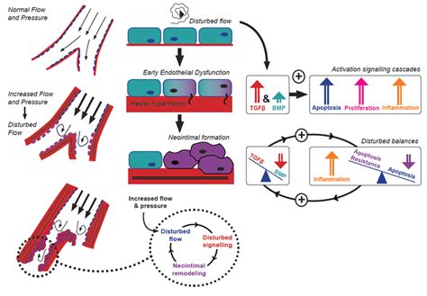 Disturbed Flow Disturbed Signaling Balances Disturbed Vasculature