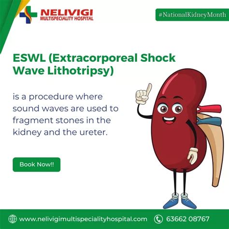 Ppt Eswl Extracorporeal Shock Wave Lithotripsy Nelivigi Urology Powerpoint Presentation