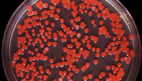 Assessment Of Antibiogram Of Biofield Energy Treated Serratia Marcescens