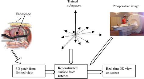 Figure 1 From Intraoperative Organ Deformation And 3d Visualization