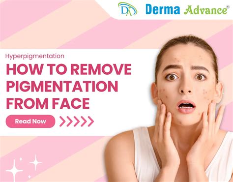 How To Remove Hyperpigmentation From Face