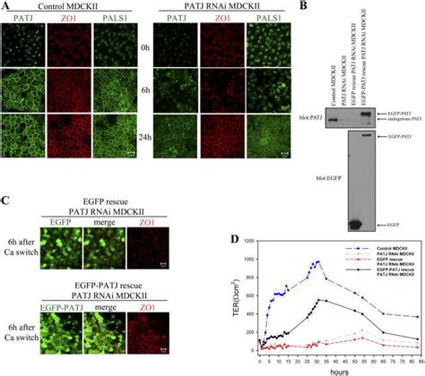 Tight Junction Formation Is Delayed In Patj Rnai Mdckii Cells And Download Scientific Diagram