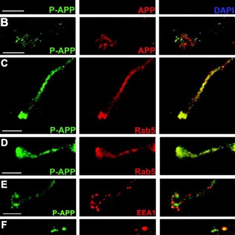 Subcellular Localization Of P App In Cultured Primary Cortical Neurons