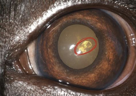 Optho 19 Flashcards Quizlet