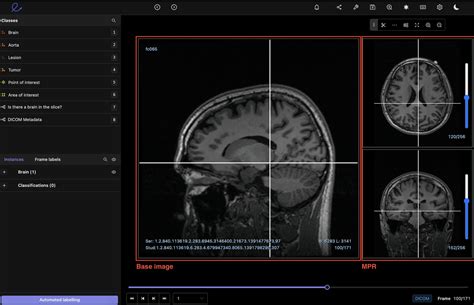 Dicom Vs Nifti Medical Image Files Encord