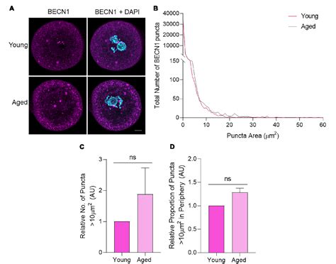Figure 5 From The Impact Of Aging On Macroautophagy In The Pre Ovulatory Mouse Oocyte Semantic