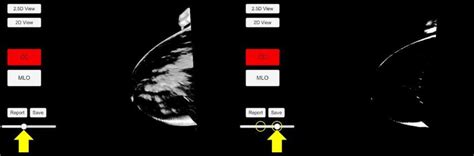 TF Manipulation Higher Values Correspond To Structures With Higher Download Scientific Diagram