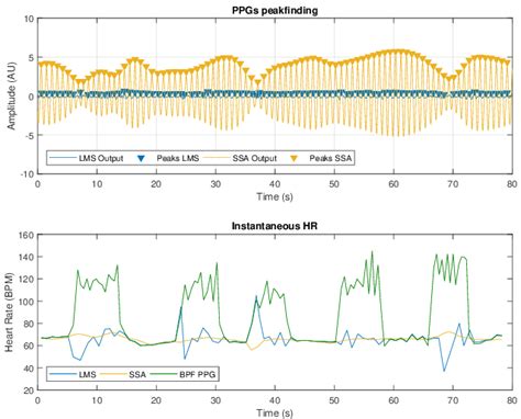 Instantaneous Heart Rate Evaluation Download Scientific Diagram