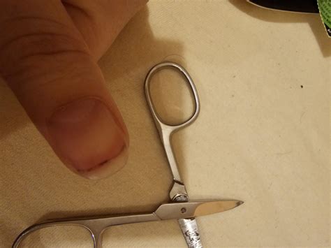 Should I Get A Tetanus Shot Rfirstaid