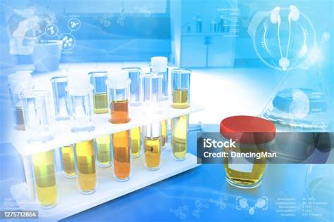 도핑 또는 탄산 칼슘에 대한 소변 샘플 테스트 현대 오염 대학 클리닉의 테스트 튜브 의학 3d 일러스트 산도 값에 대한 스톡 사진 및 기타 이미지 Istock