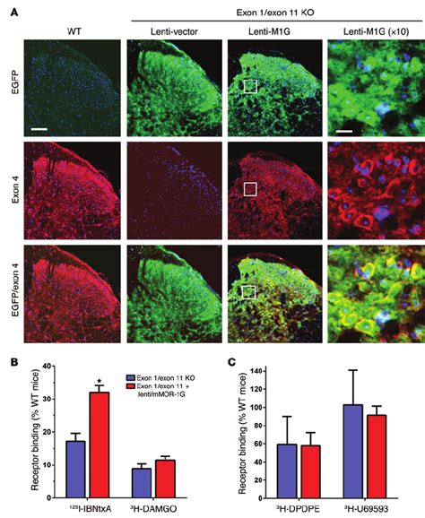 Lentivirus Expression In The Spinal Cord Following Intrathecal
