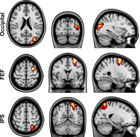Figures And Data In Reconfiguration Of Functional Brain Networks And