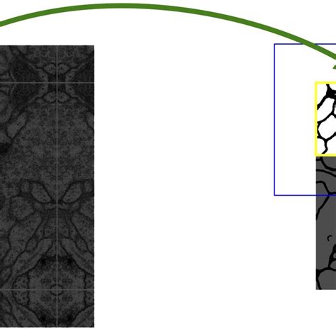u net overlap tile strategy for seamless segmentation of arbitrary