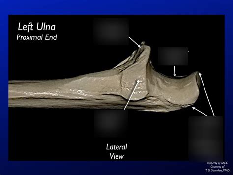 Left Ulna Diagram Quizlet
